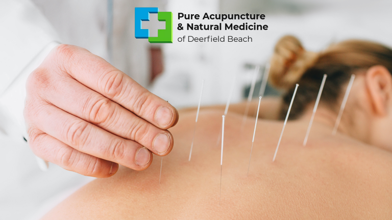 Acupuncture Near Me | Traditional Chinese Medicine